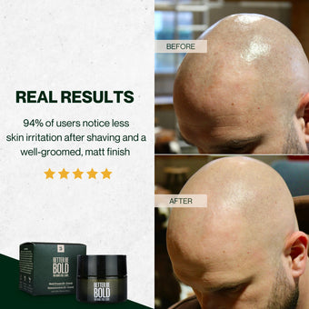 BETTER BE BOLD | The No. 1 in Premium Bald Care made in Germany ...
